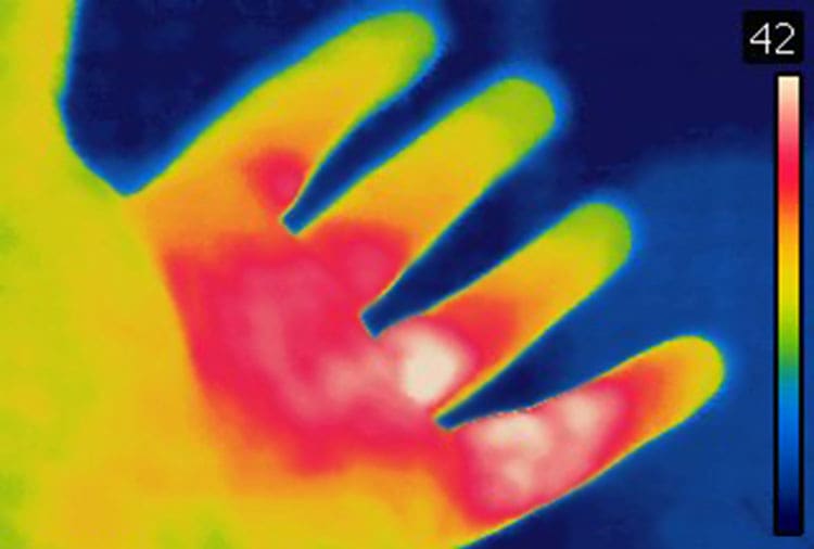 Medical Diagnostics - UtopiaCompression